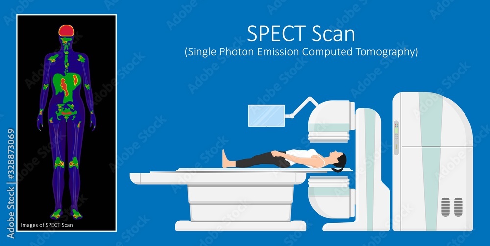 Vetor SPECT scan radiologist single computed image CT PET 3D ...