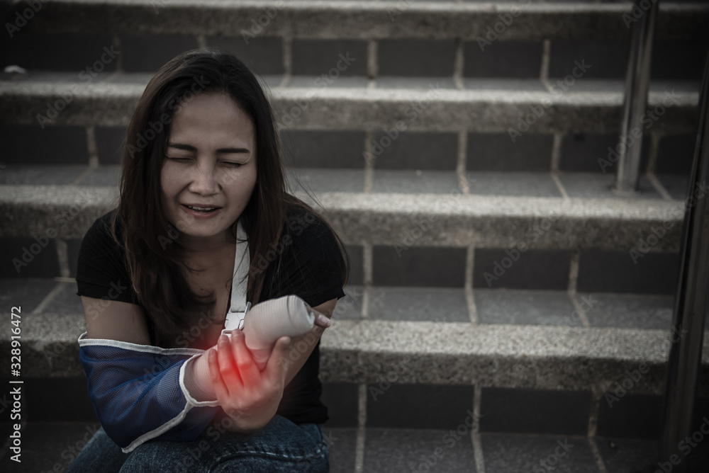 A beautiful Asian girl broke her arm and splinted,Woman accidentally ...