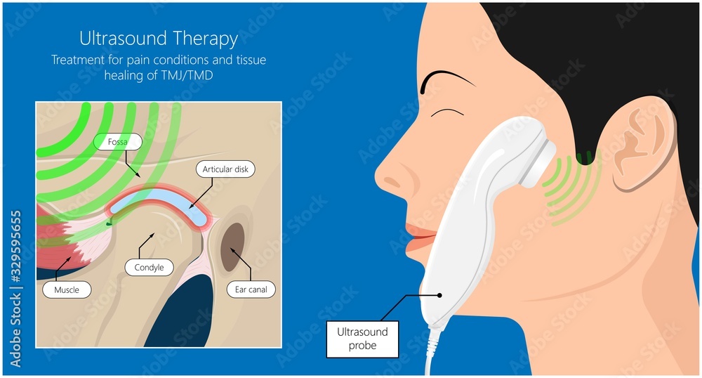 Temporomandibular Joint Disorders TMD TMJ treat pain displaced disc ...