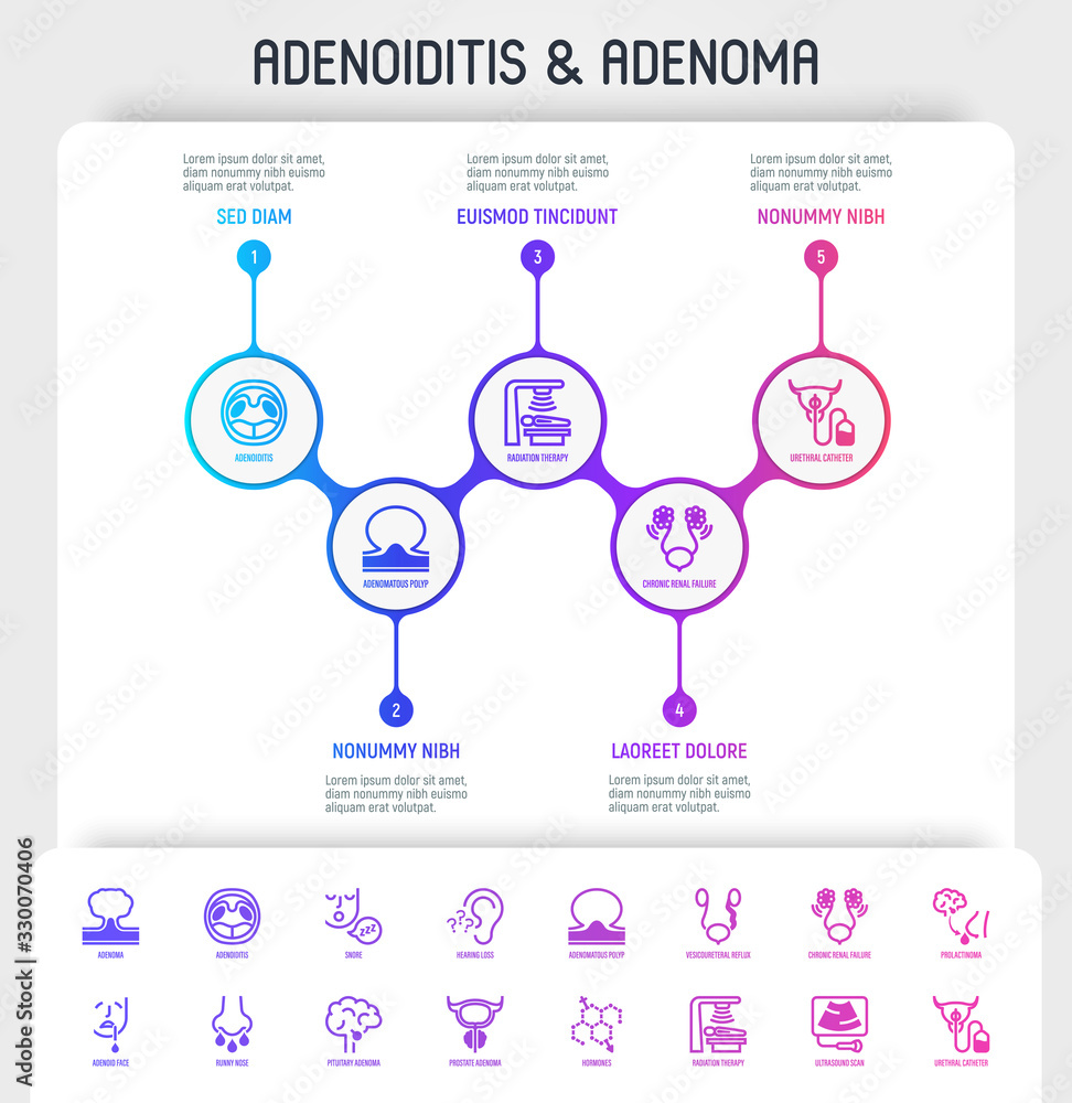 Adenoiditis and adenoma infographics with thin line icons. Benign tumor ...