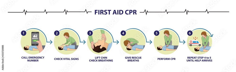 Emergency first aid cpr procedure Stock Vector | Adobe Stock