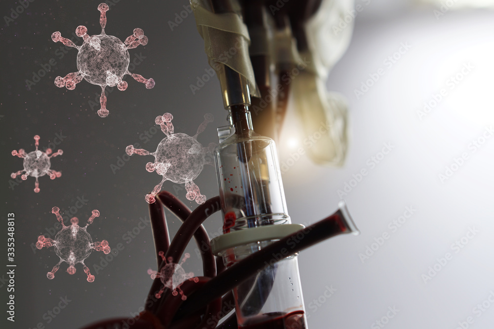 Coma patient on hopital bed take care by doctor nurse due to serious ...