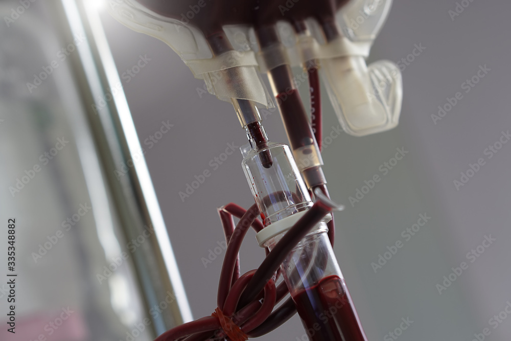 Coma patient on hopital bed take care by doctor nurse due to serious ...