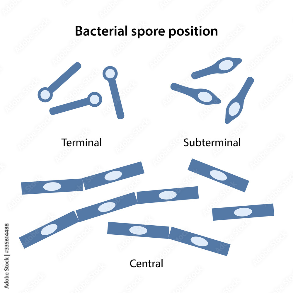 The position of the bacillus spores: central, terminal, subterminal ...
