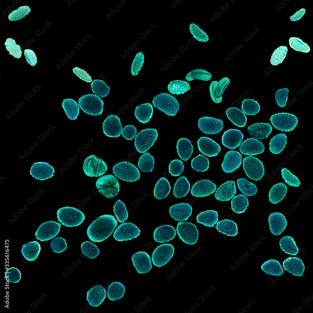 Magnified pollen grains under the light microscope. Grains of pollen ...