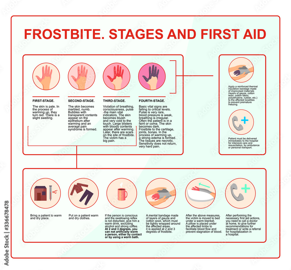 Frostbite - symptoms, protection and treatment. infographics ...