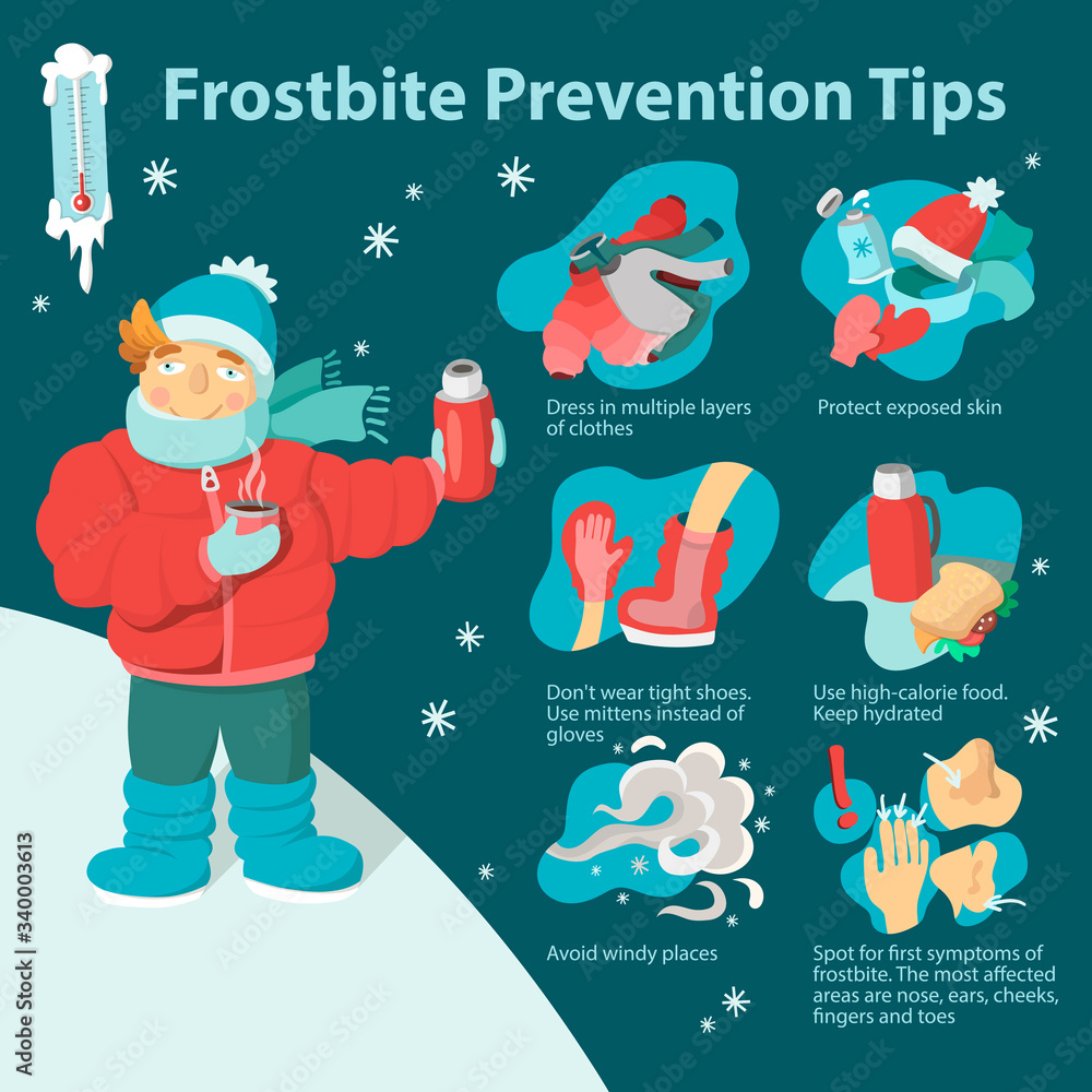 Frostbite prevention tips. Cartoon infographic, poster or flyer. Stock ...