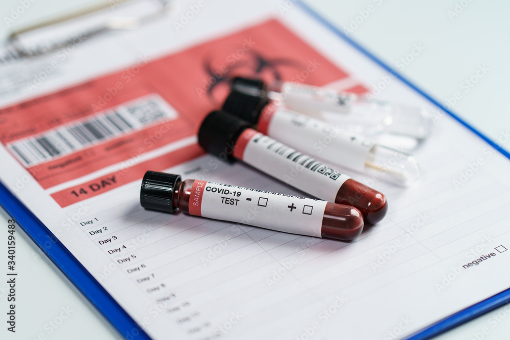 Blood test samples tube, reagent testing tube and swab collection kit ...