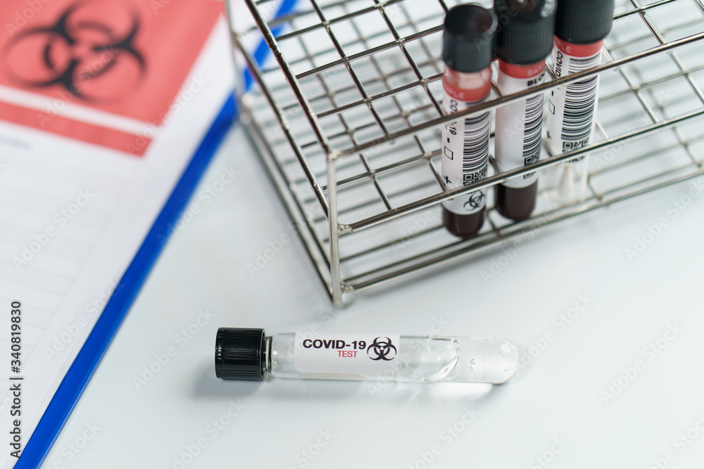 Blood test samples tube, reagent testing tube and swab collection kit ...