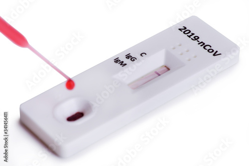Rapid Covid-19 coronavirus strip test cassette for antibody or sars-cov ...