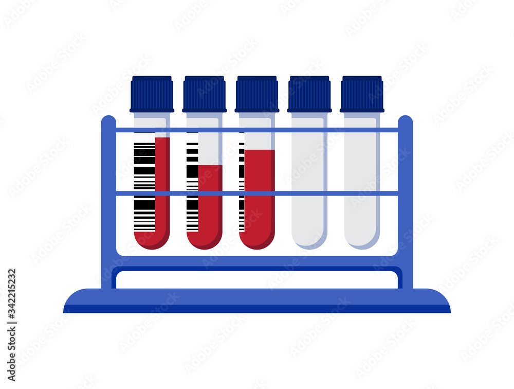 Set test tube with blood. Virus analysis. Test tubes on stand awaiting ...