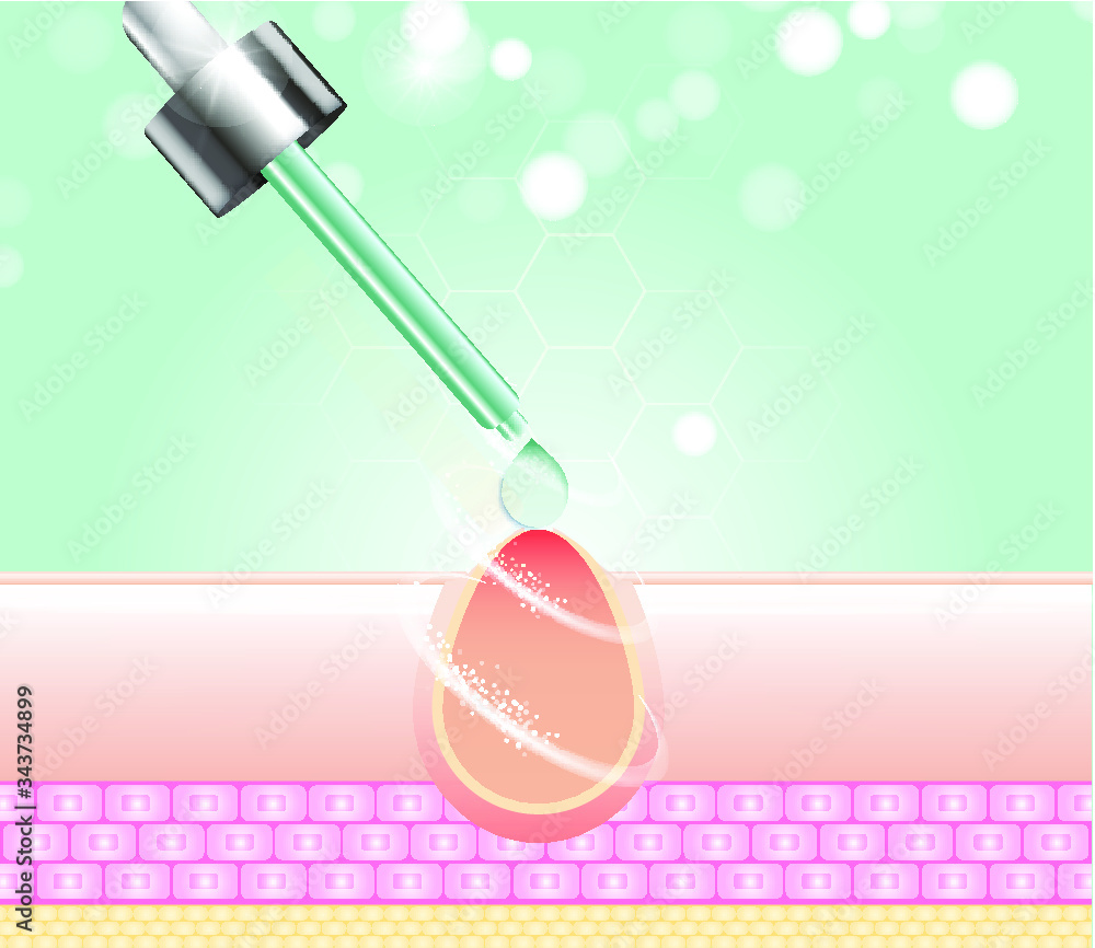 Three main layer of the human skin. skin aging stages diagrams, ollagen ...