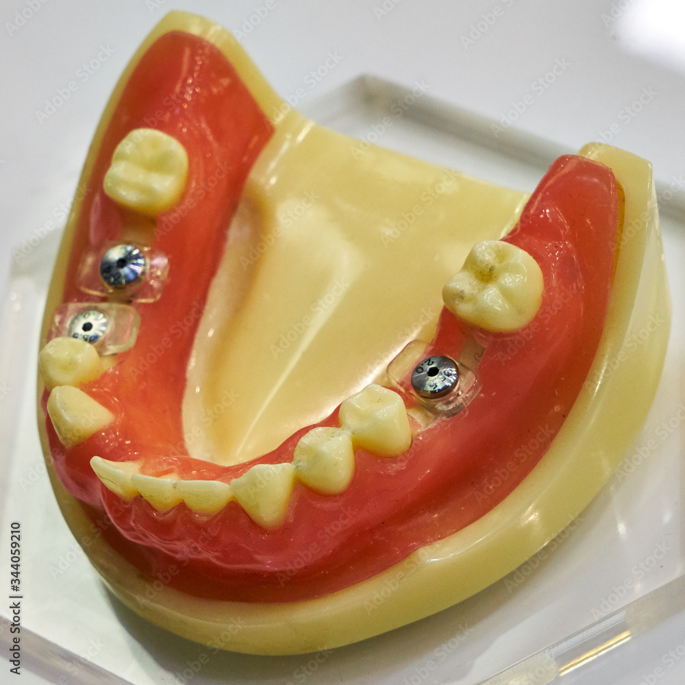 Model of the human jaw. The cast of the human jaw. Dental equipment ...