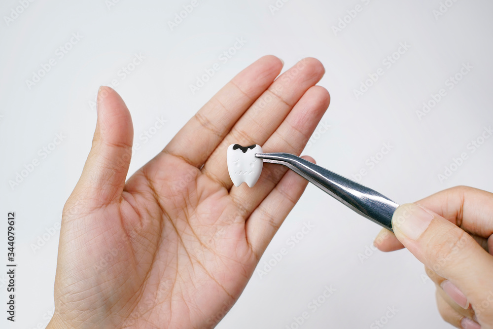 Cavity and Decayed tooth pinching on hand, it is the result of an ...