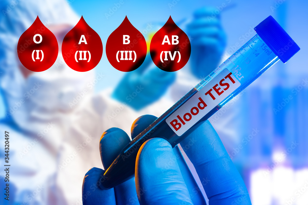 Determination of blood group. Four blood types. Laboratory blood tests ...