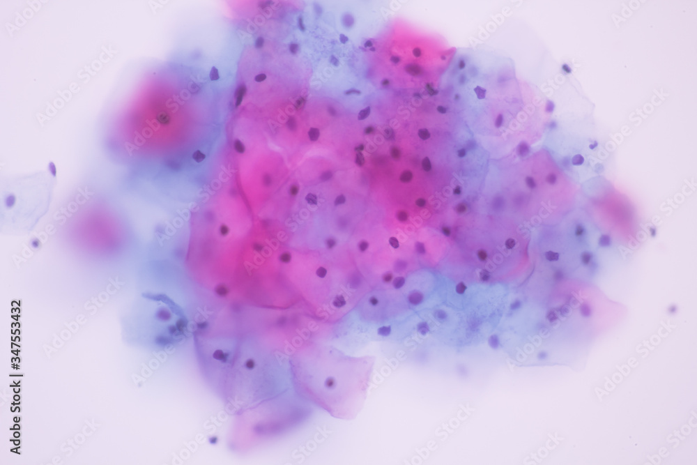 View in microscopic of normal human cervical cells.Squamous epithelium ...