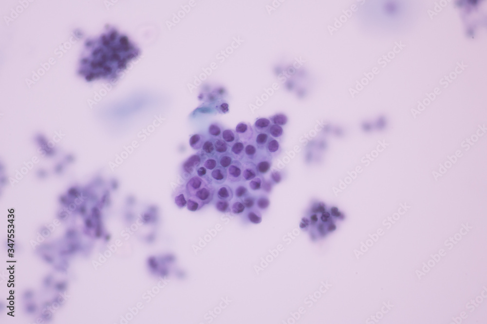 View in microscopic of normal human cervical cells.Endocervical ...