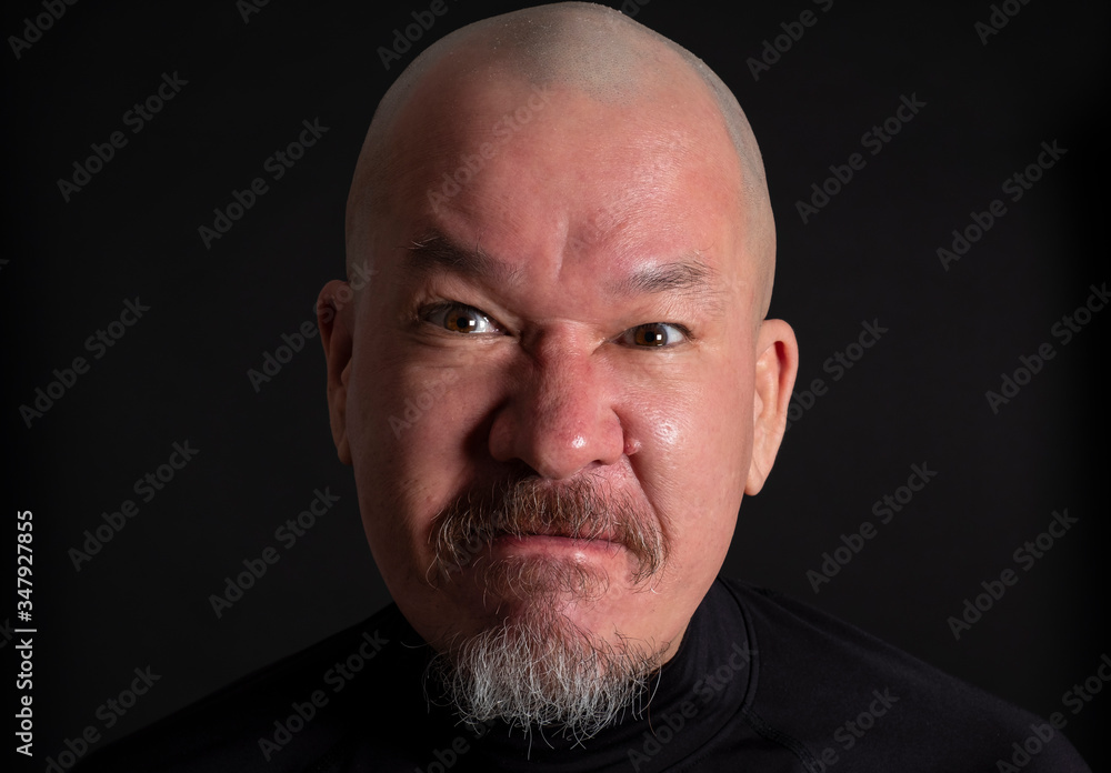 Photo Stock A Bald Man with Beard and an Angry Expression on His Face ...