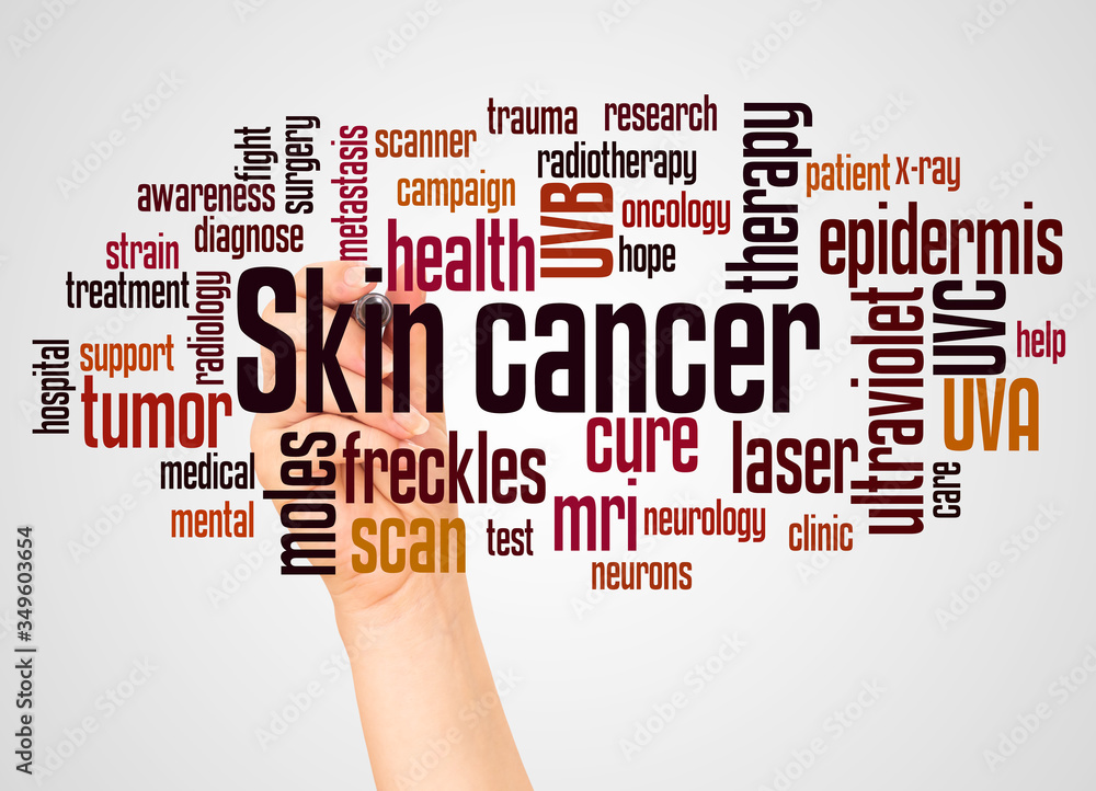 Skin cancer (non-melanoma) word cloud and hand with marker concept ...