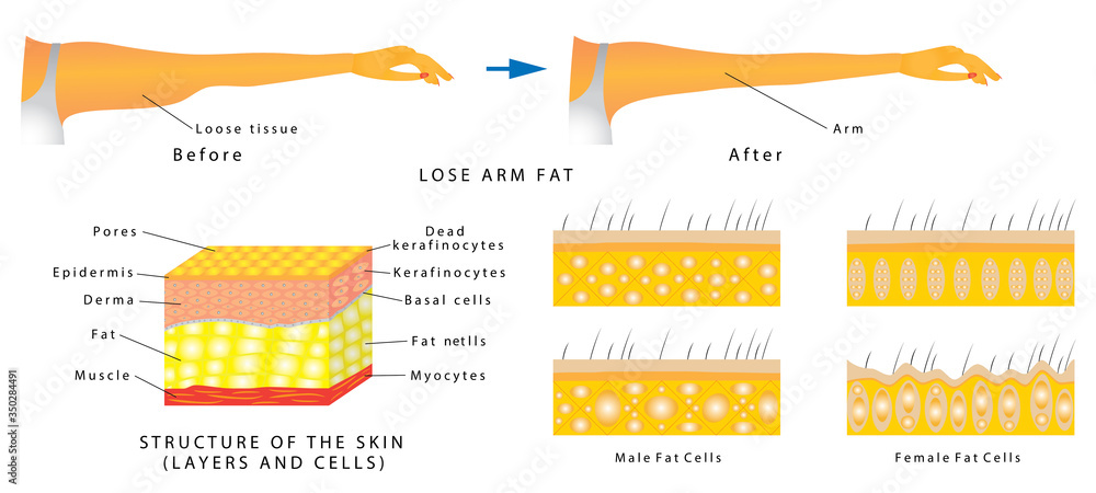 Lose arm fat. Subcutaneous fat distribution in human. Anatomy of Human ...