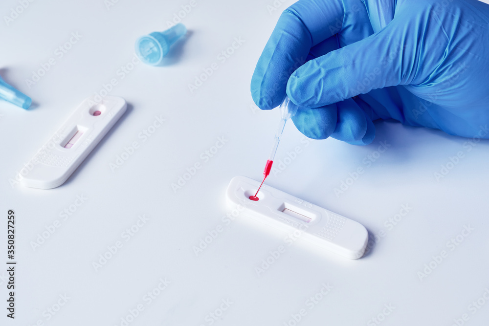 Stock-Foto „Rapid COVID-19 test for detection of specific antibodies ...
