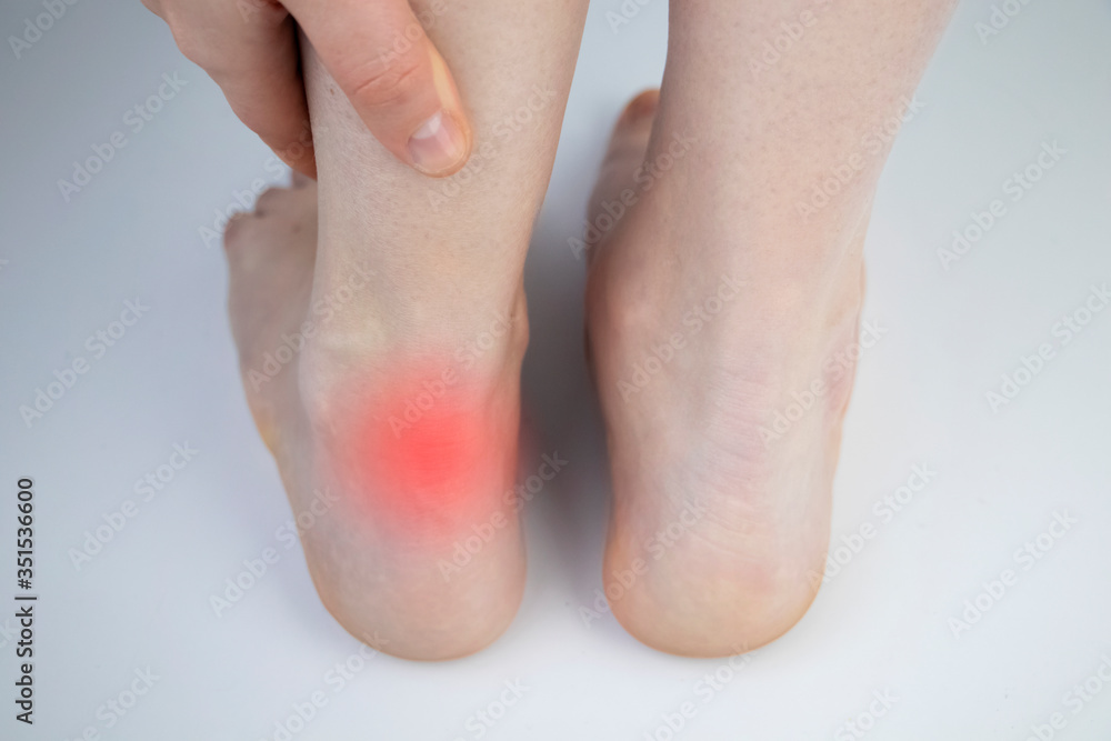 An orthopedic doctor examines a woman's leg. Achilles tendon and ankle ...