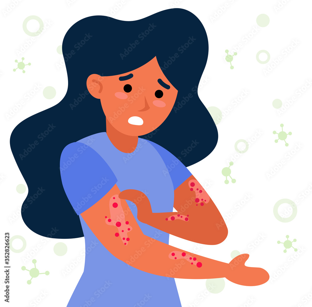 Woman with strong allergy symptoms flat vector illustration. Cartoon ...