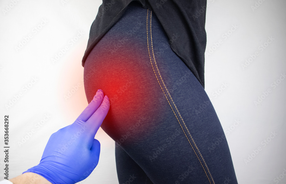 ภาพถ่าย Stock A woman suffers from pain in the buttock. The doctor ...