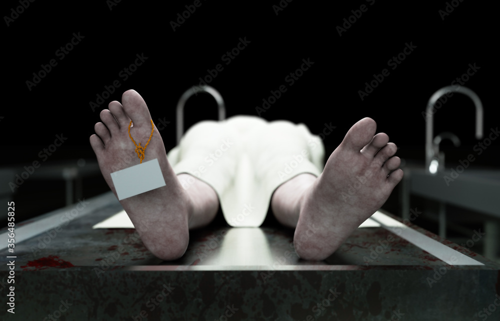 cadaver, dead male body in morgue on steel table. Corpse. Autopsy ...