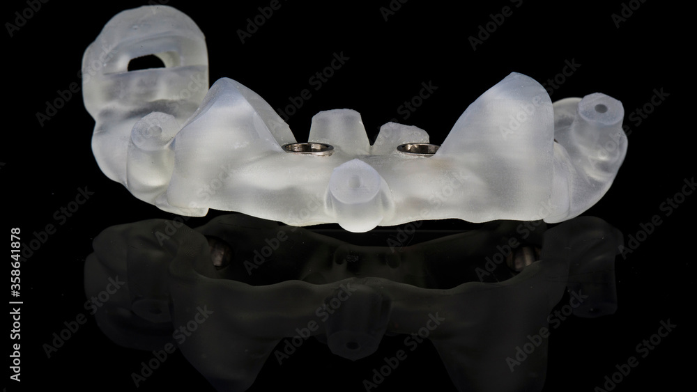 unusual dental template for the integration of dental implants, subject ...