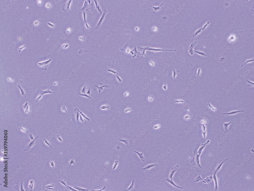 Homo sapiens (Human) Skin Fibroblast Cells (CRL-2522 cells) were ...