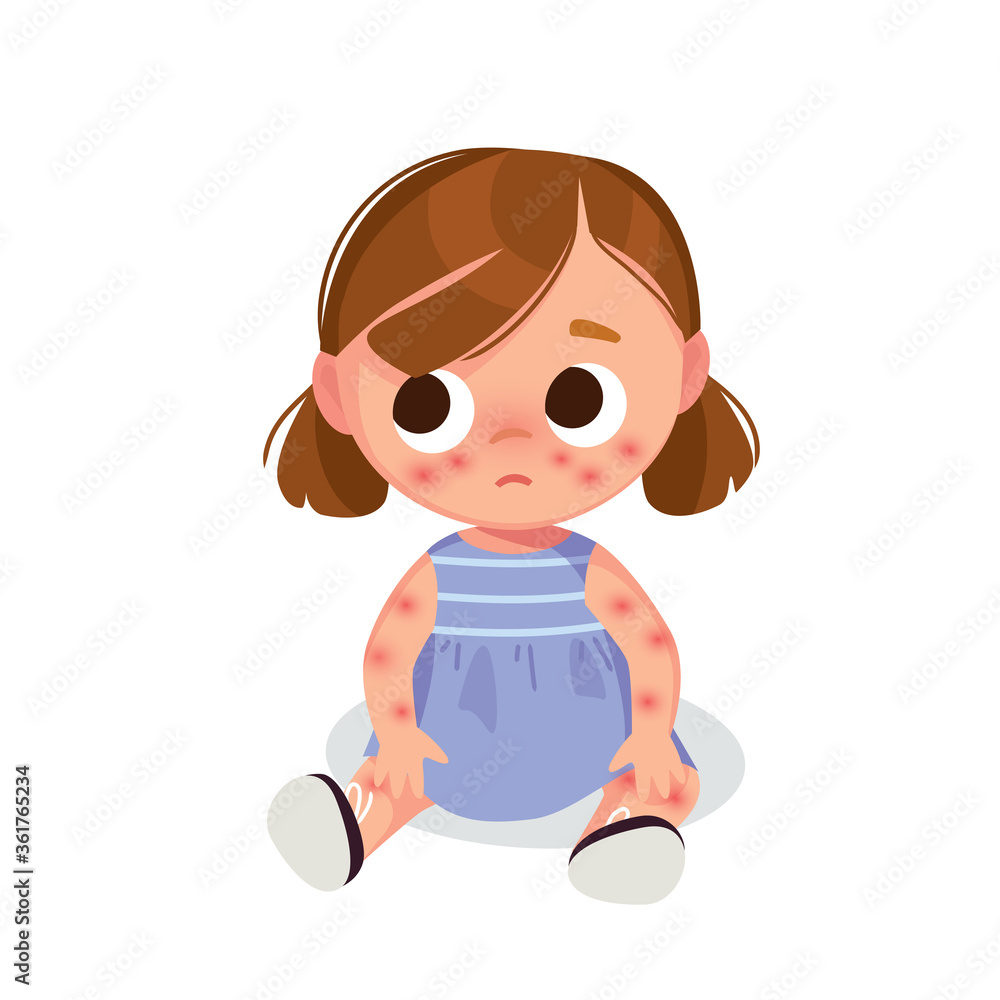 Baby girl with skin problem. Allergic child with skin disease, skin ...