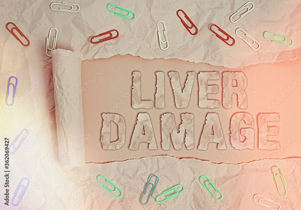 Stock-Foto „Conceptual hand writing showing Liver Damage. Concept ...