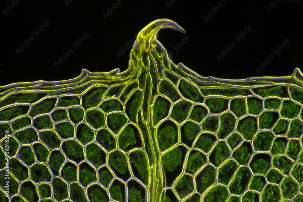 Microscopic view of moss leaf (Plagiomnium affine). Darkfield ...