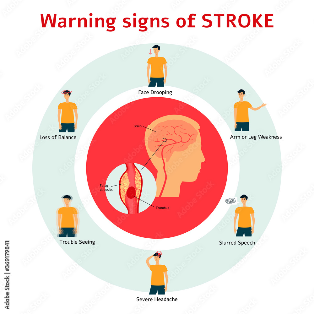 Stroke warning signs - flat cartoon infographic of man showing symptoms ...