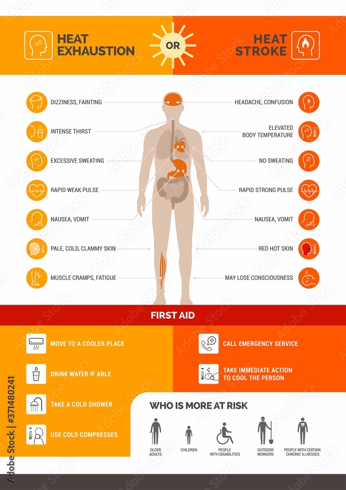 Vector de Stock Heat exhaustion and heast stroke infographic | Adobe Stock