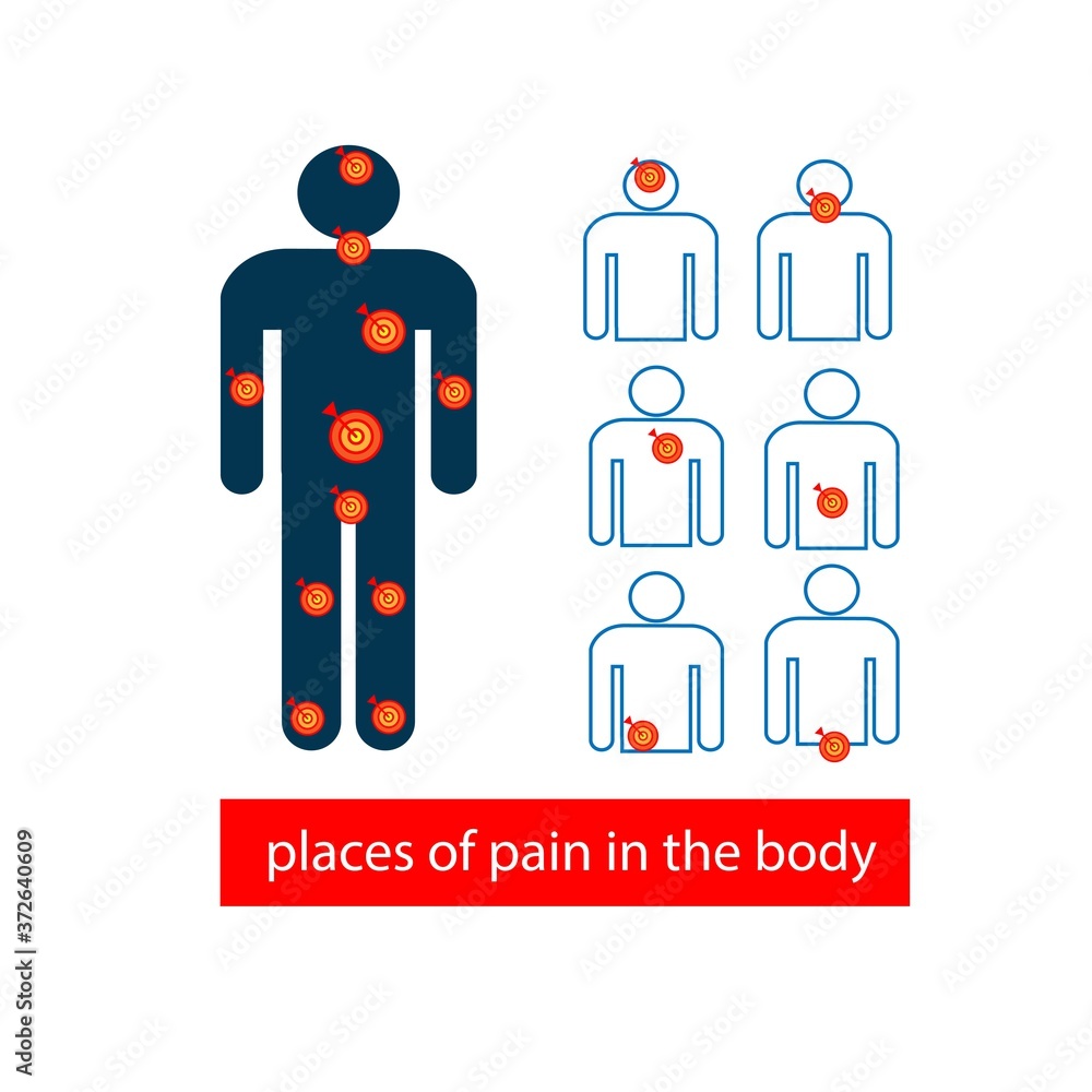 Stock-Vektorgrafik „Places where pain is localized on the human body ...