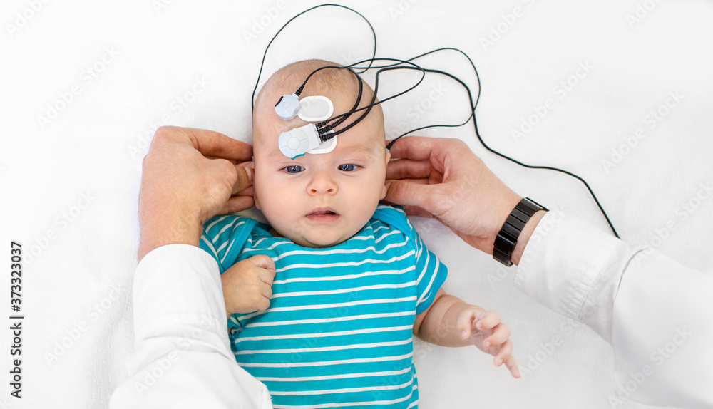 Newborn hearing screening and diagnosis at the hospital. Baby having ...