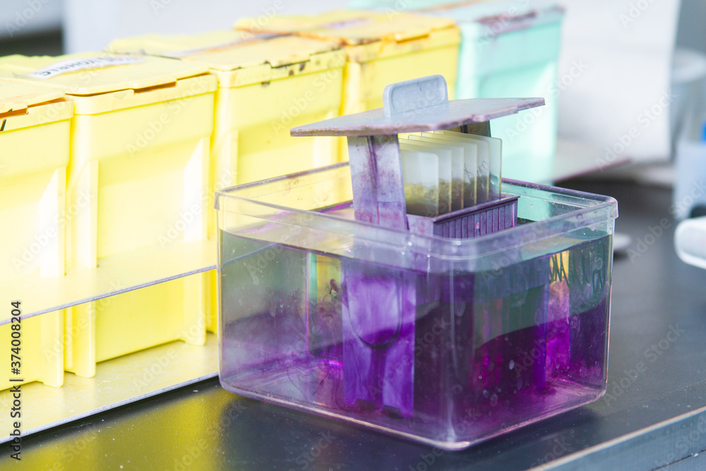 Histology test lab in hospital. Hands in gloves, tech loads slide ...