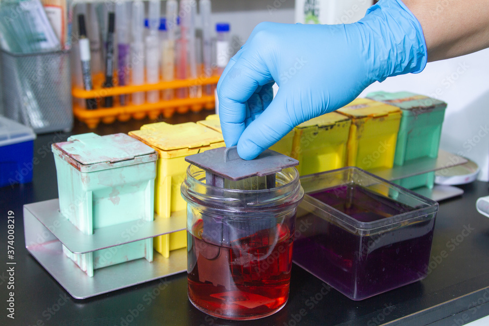 Histology test lab in hospital. Hands in gloves, tech loads slide ...