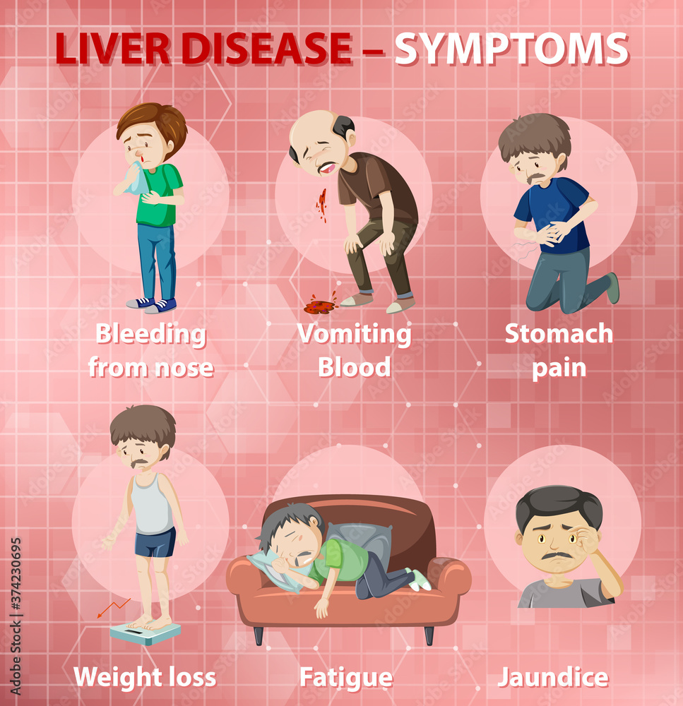 Liver disease symptoms cartoon style cartoon style infographic Stock ...