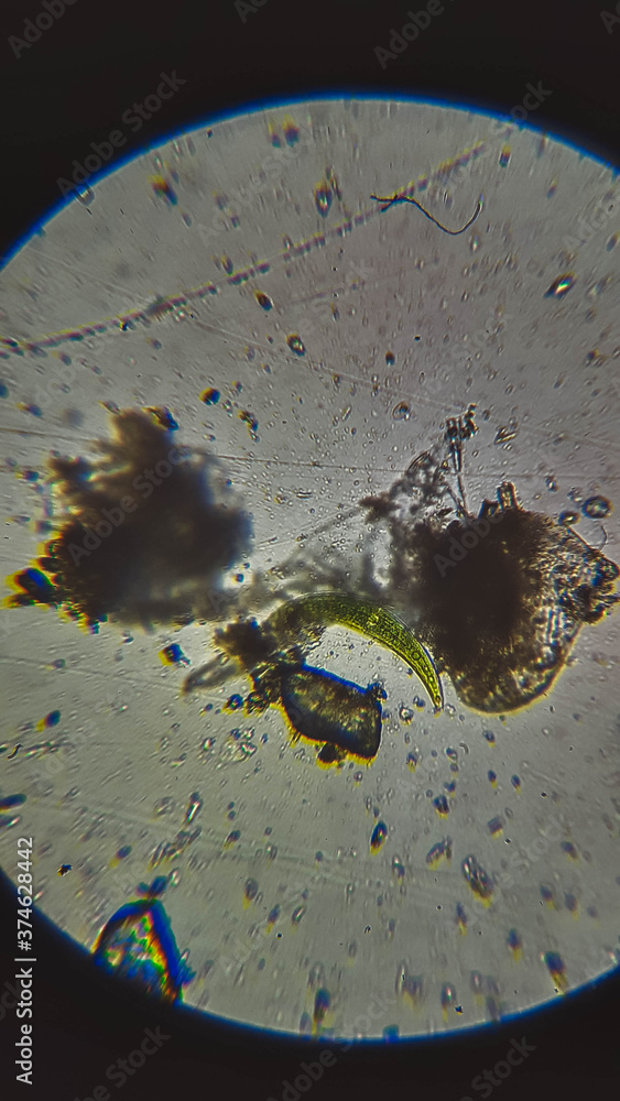 Stock-Foto „Mycetozoa slime mold and Purple sulfur bacteria PSB in dead ...