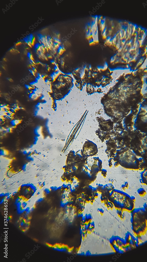 Mycetozoa slime mold and Purple sulfur bacteria PSB in dead shell of ...