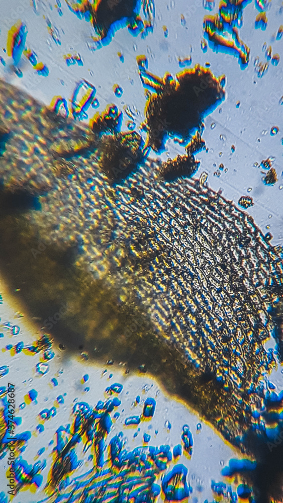 Foto de Stock Mycetozoa slime mold and Purple sulfur bacteria PSB in ...