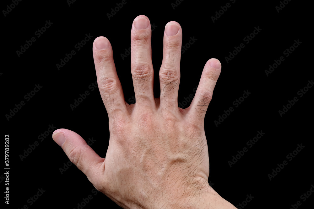 Right hand, adult male, facing downwards, showing back of hand ...
