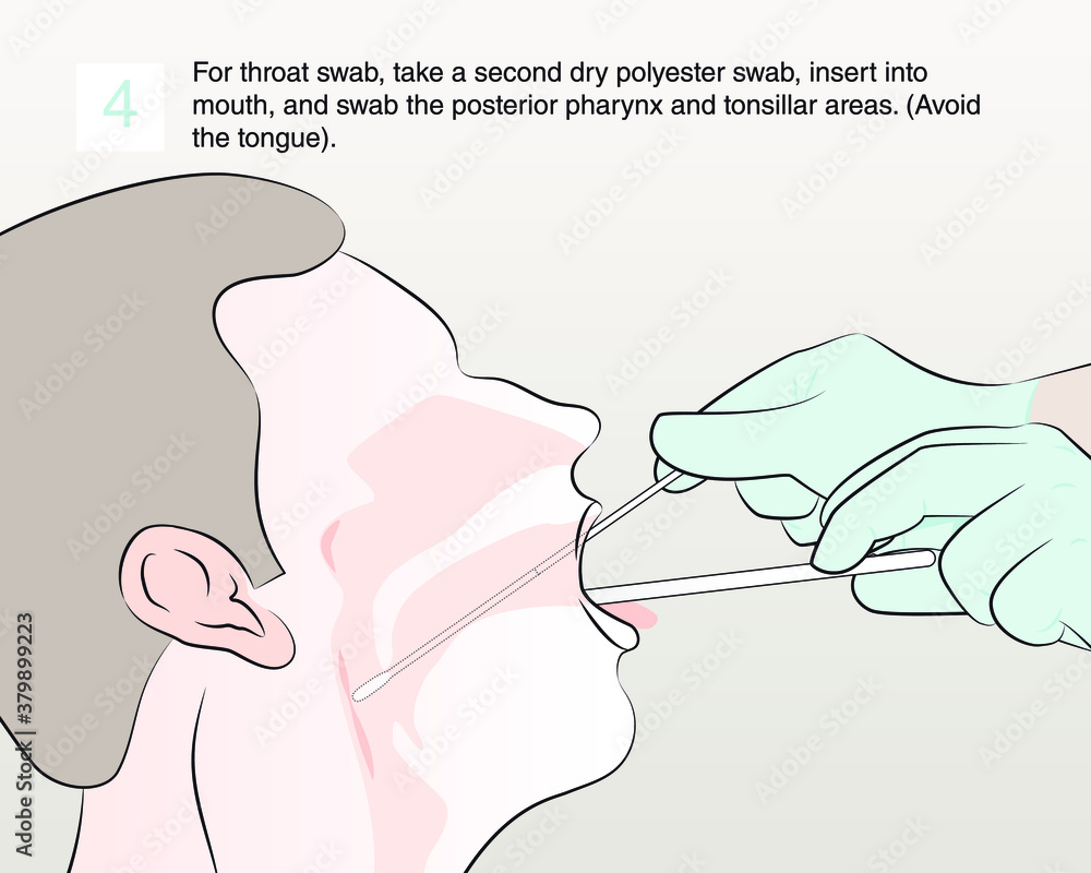 step 4 : For throat swab, take a second dry polyester swab, insert into ...