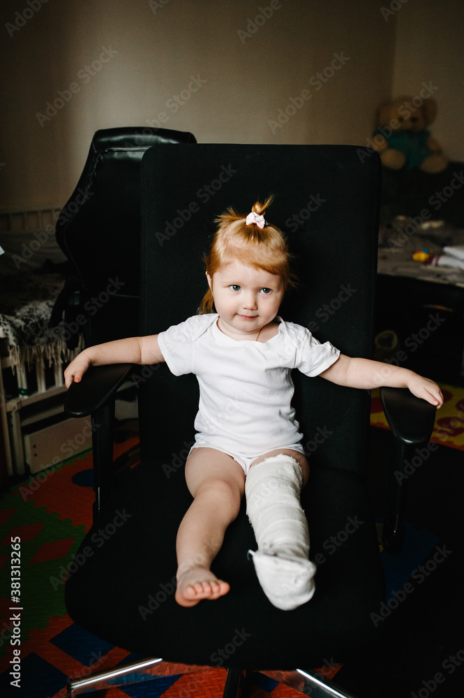 Broken left foot, bone, calf, ankle, leg in plaster, splint of toddler ...