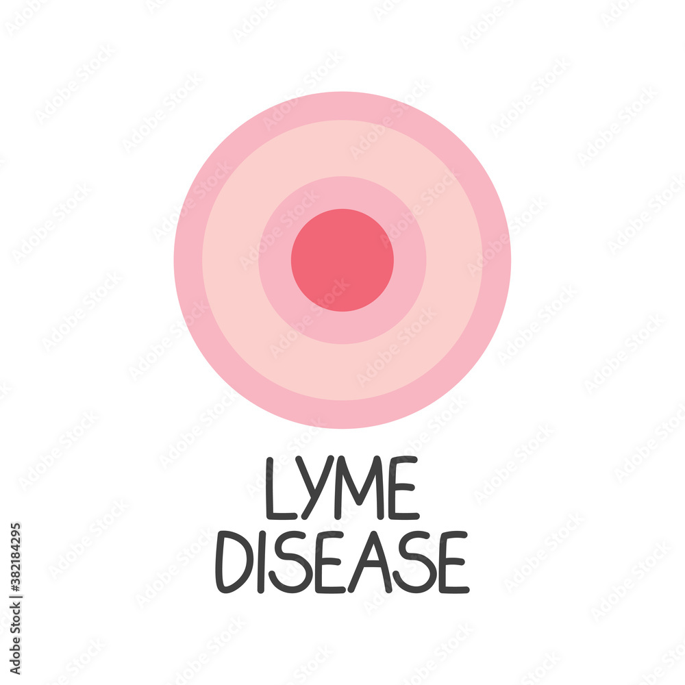 lyme disease text and erythema migrans rash concept- vector ...