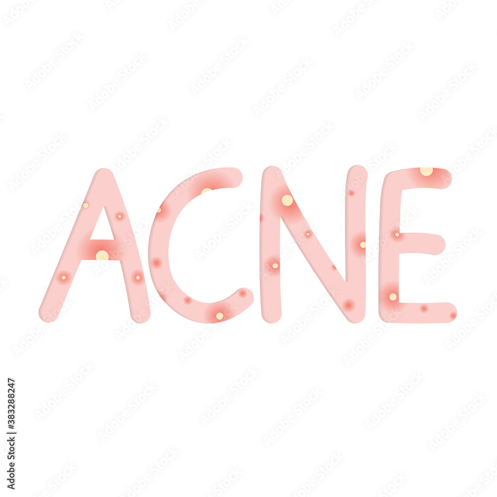 acne word concept- vector illustration Stock Vector | Adobe Stock
