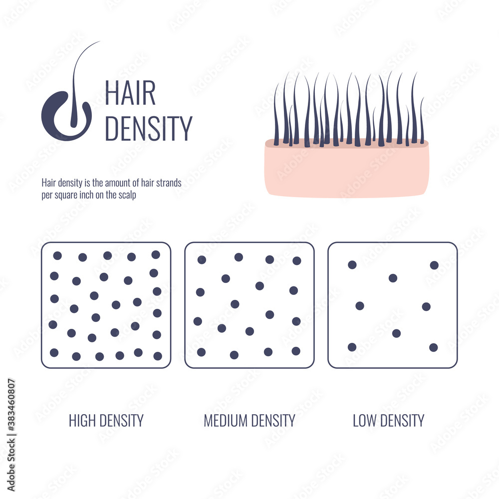 Hair density types classification set. Low, medium, high hair volume on ...